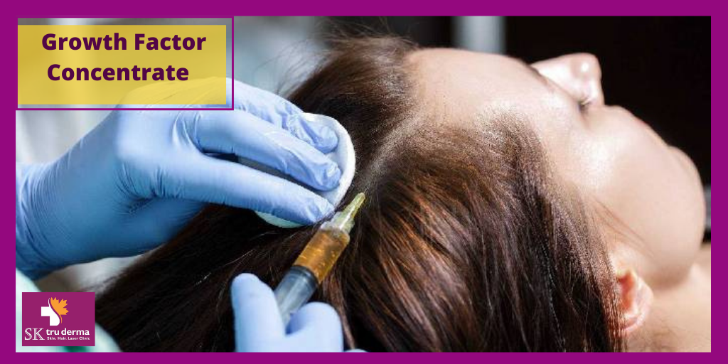 Growth factors concentrate on hair and facial Rejuvenation, scars