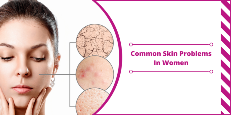 Common Skin Problems In Women